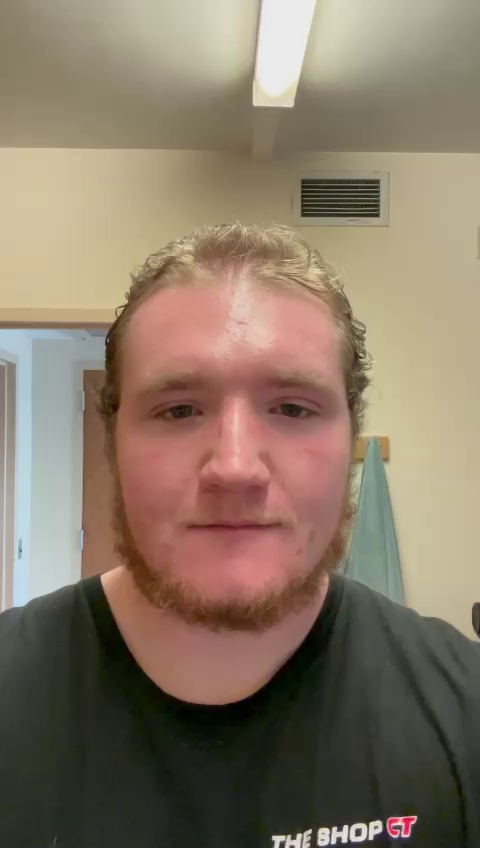 Retina_Imaging Object Detection Dataset and Pre-Trained Model by ...