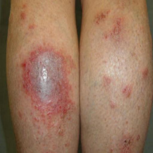 skin-lesion-classification with 97.8% accuracy Classification Dataset ...