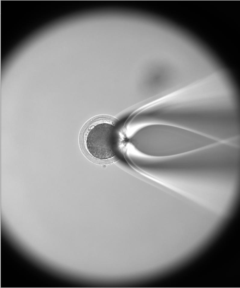 egg Segmentation Instance Segmentation Dataset by class