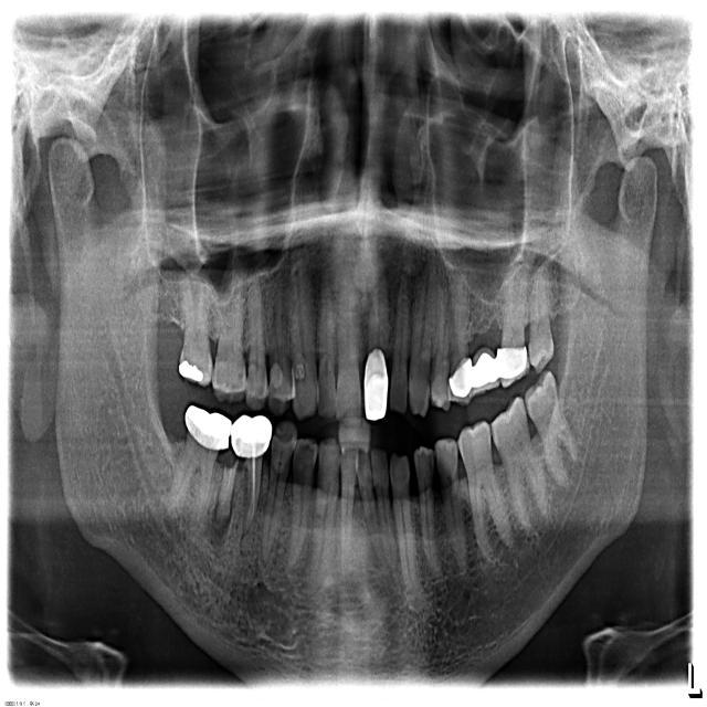 opg detect Instance Segmentation Dataset by detect