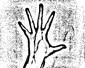 hand_vein Instance Segmentation Model by Roboflow First Workspace