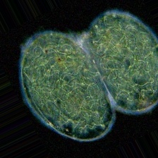 Spherical Bacteria Detection Object Detection Dataset by Microbe classification