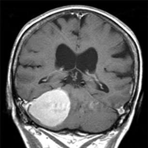 Detection Projeleri - Roboflow Universe