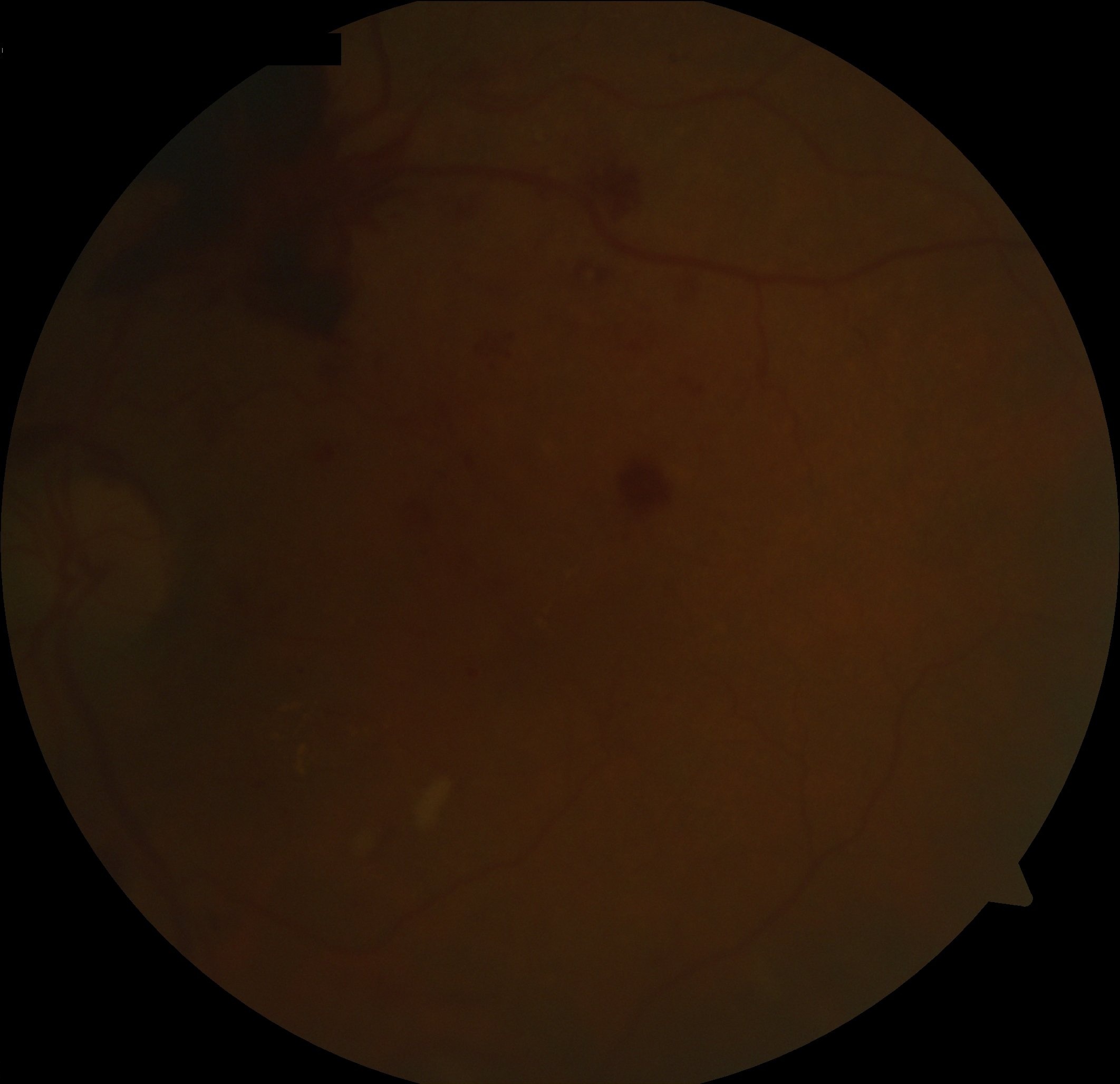 DR Classification Dataset by College