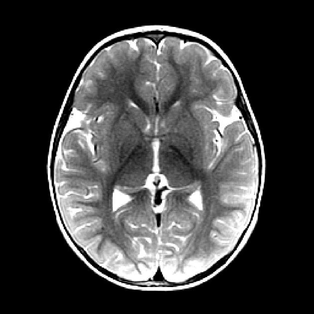 valid_brain Instance Segmentation Dataset by Firr