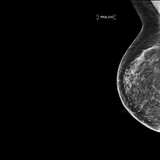 Anums Labeling Workspace - Roboflow Universe