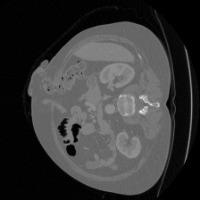 python (python-hdqyy) - Roboflow Universe