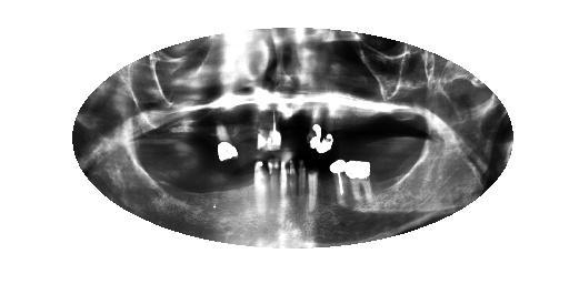 Dentalai I4clz Fsod Txmm Object Detection Dataset By Roboflow 20 Vl Fsod