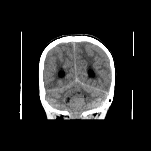 medical 5 Instance Segmentation Model by medical images