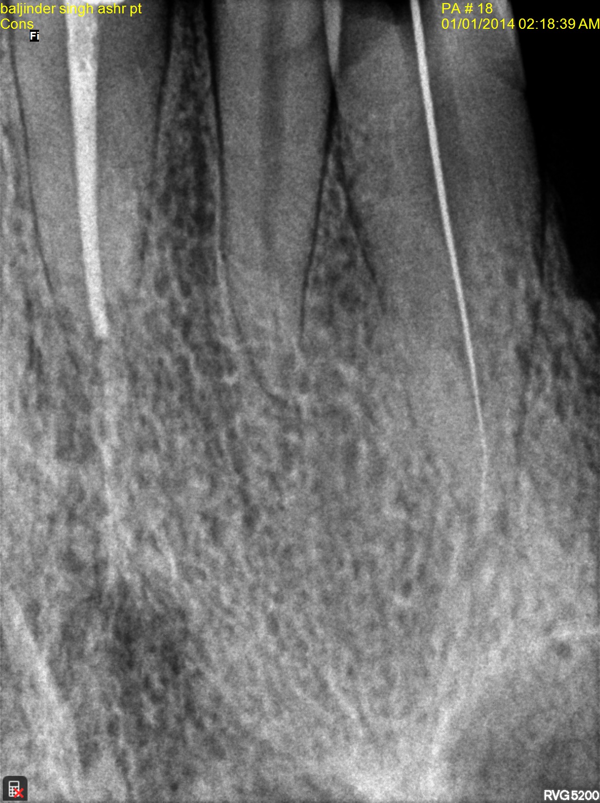 Yash Singhal (yash-singhal-8qukb) - Roboflow Universe
