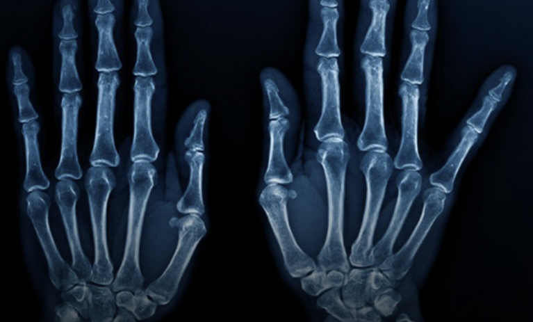 dkdk - Roboflow Universe