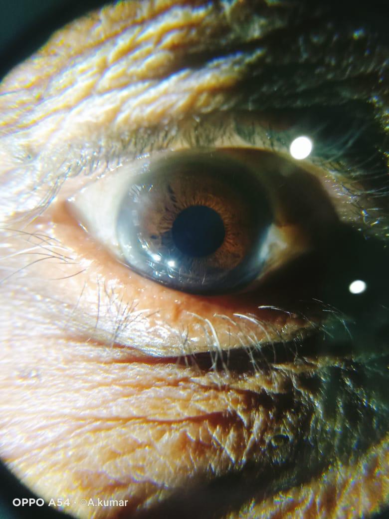 Eye Pupil Instance Segmentation Model by sam