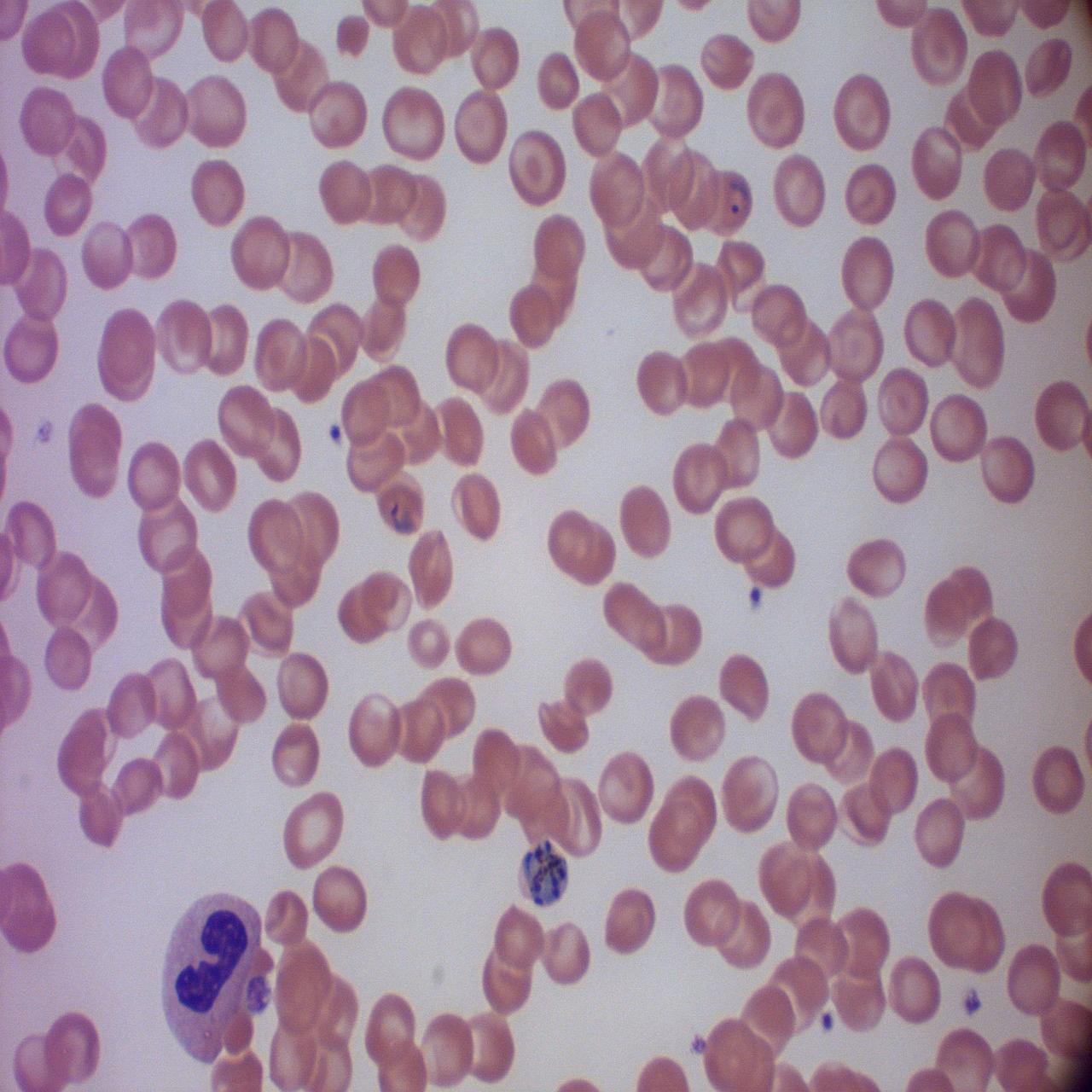 Malaria_syn Object Detection Model by Samisaid