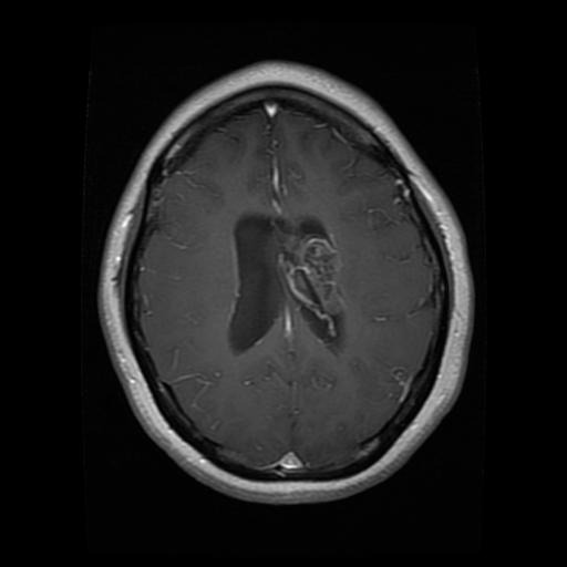 Zeta_Model Object Detection Dataset and Pre-Trained Model by ZETA