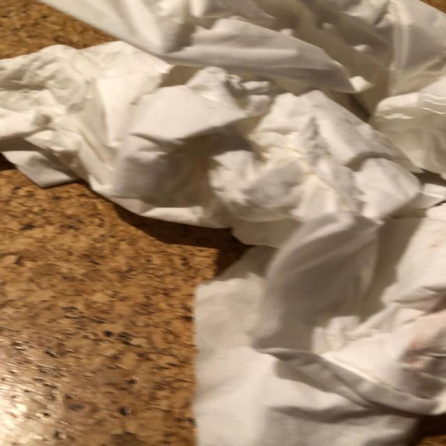 Kitchen Tissue Detection Object Detection Dataset By Tissue Detection
