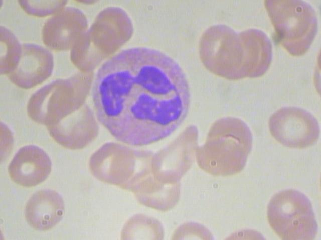 Blood Cell Detection Object Detection Dataset and Pre-Trained Model by ...