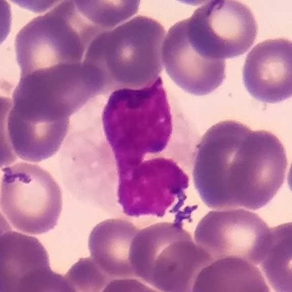 White Blood Cell Instance Segmentation Dataset by number