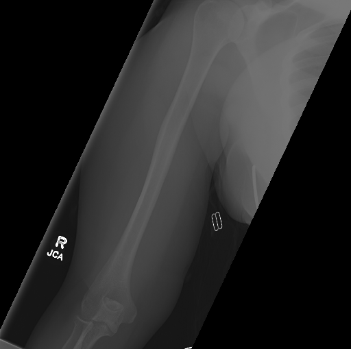 Science Research 2023: Binary Classification: ResNet-50 HUMERUS ... Science Research 2023: Binary Classification: ResNet-50 HUMERUS ...