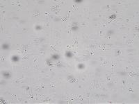 Roboflow 100-VL (rf100-vl) - Roboflow Universe