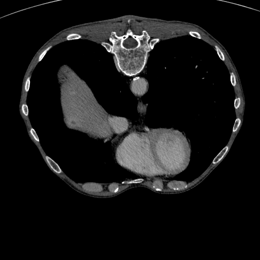 Liver CT Instance Segmentation Dataset by label