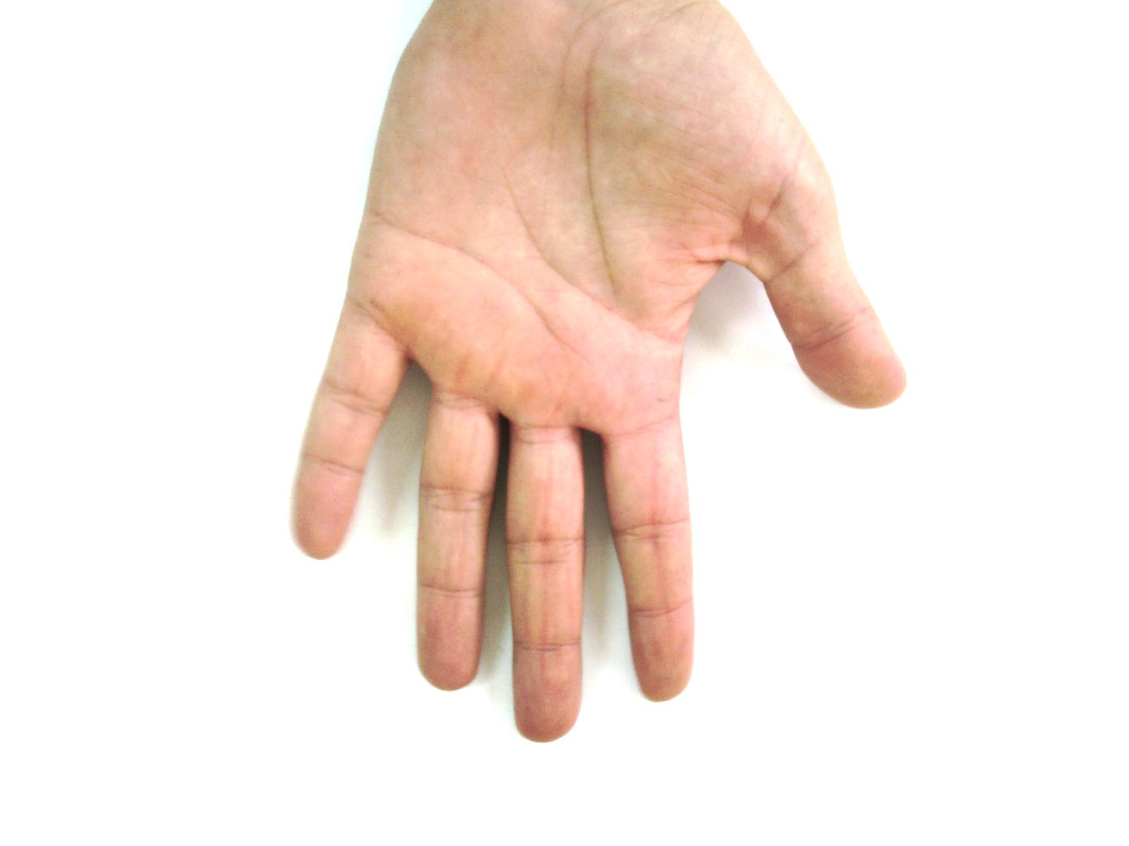 palm Object Detection Dataset by cromlehg