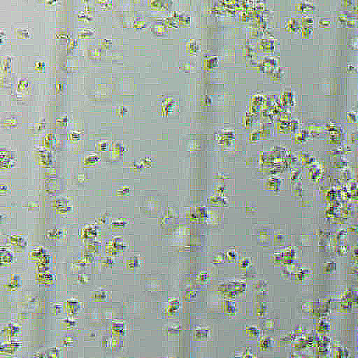 Blood Cell Detection v2 Object Detection Model by Blood Cell Detection v2