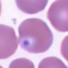 pbs_inclusion_rbc Instance Segmentation Dataset by Flying Banana