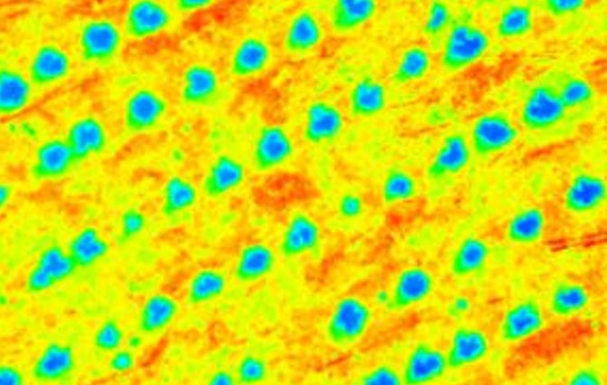 Tree Detection Object Detection Dataset And Pre Trained Model By Rpas