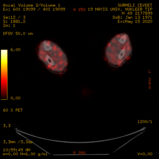 Surmeli_Cevdet Object Detection Dataset by Akcigerkanseri3