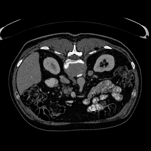 Final_Project-2 Object Detection Dataset by AKANKSHA