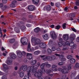 Thyroid Cancer Detection Object Detection Model by Thesis