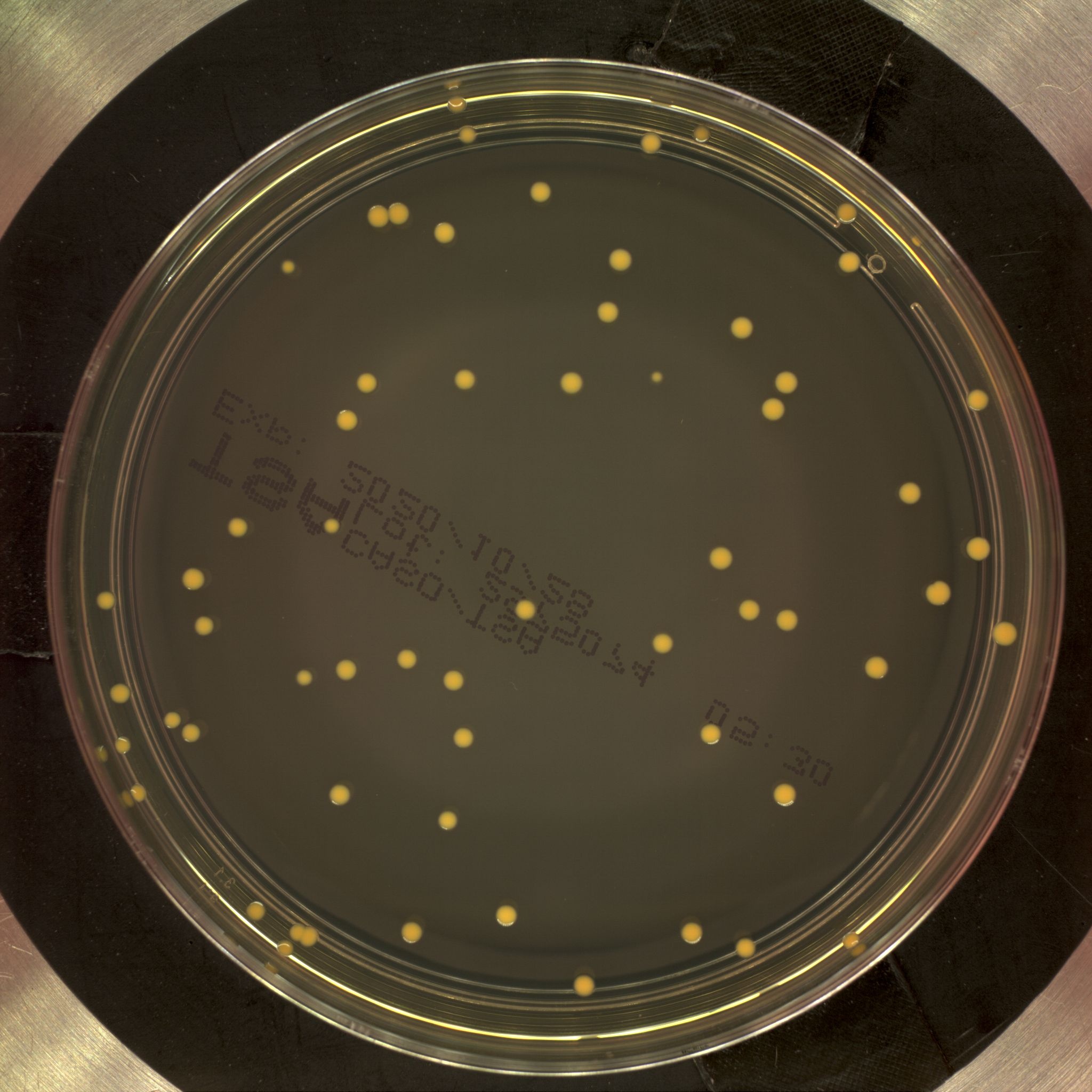 Bacteria Colony Object Detection Instance Segmentation Dataset and Pre-Trained Model by Latihan