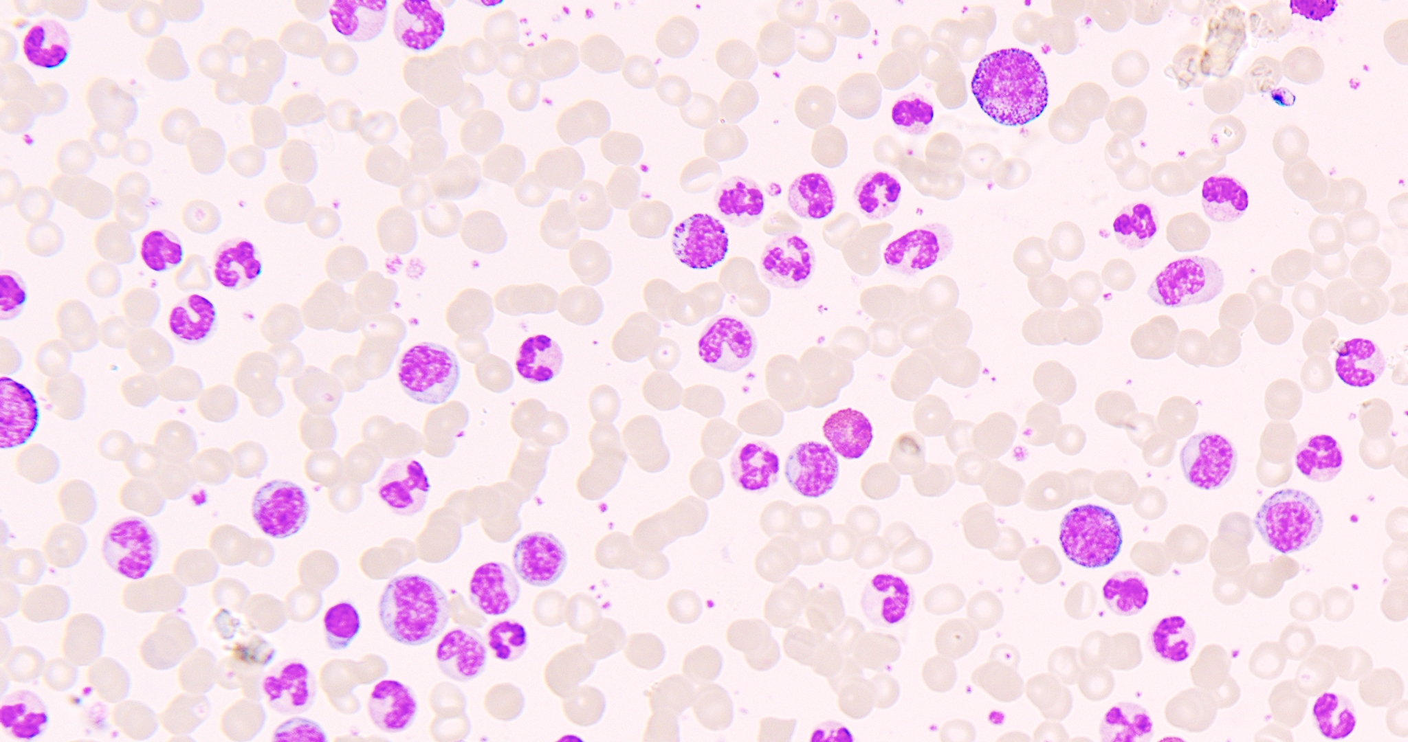 wbc Object Detection Dataset by workspace