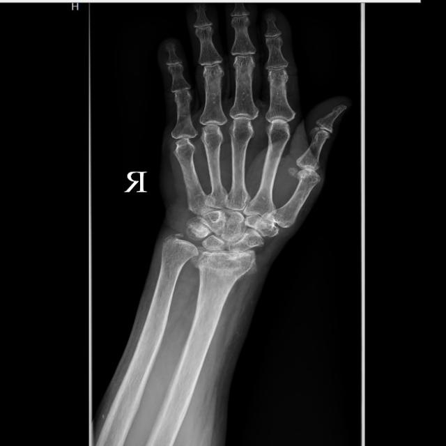 How to Use the object detection Object Detection API