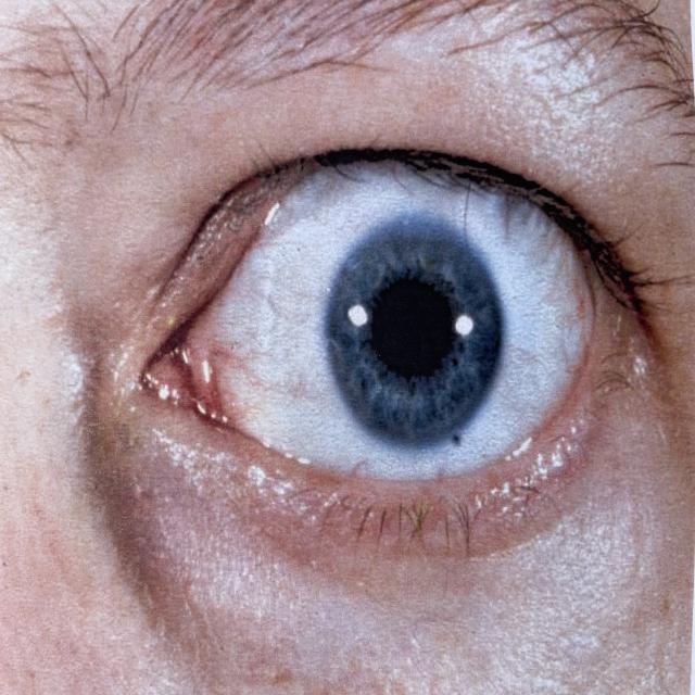 eye tracking Object Detection Dataset by CV project