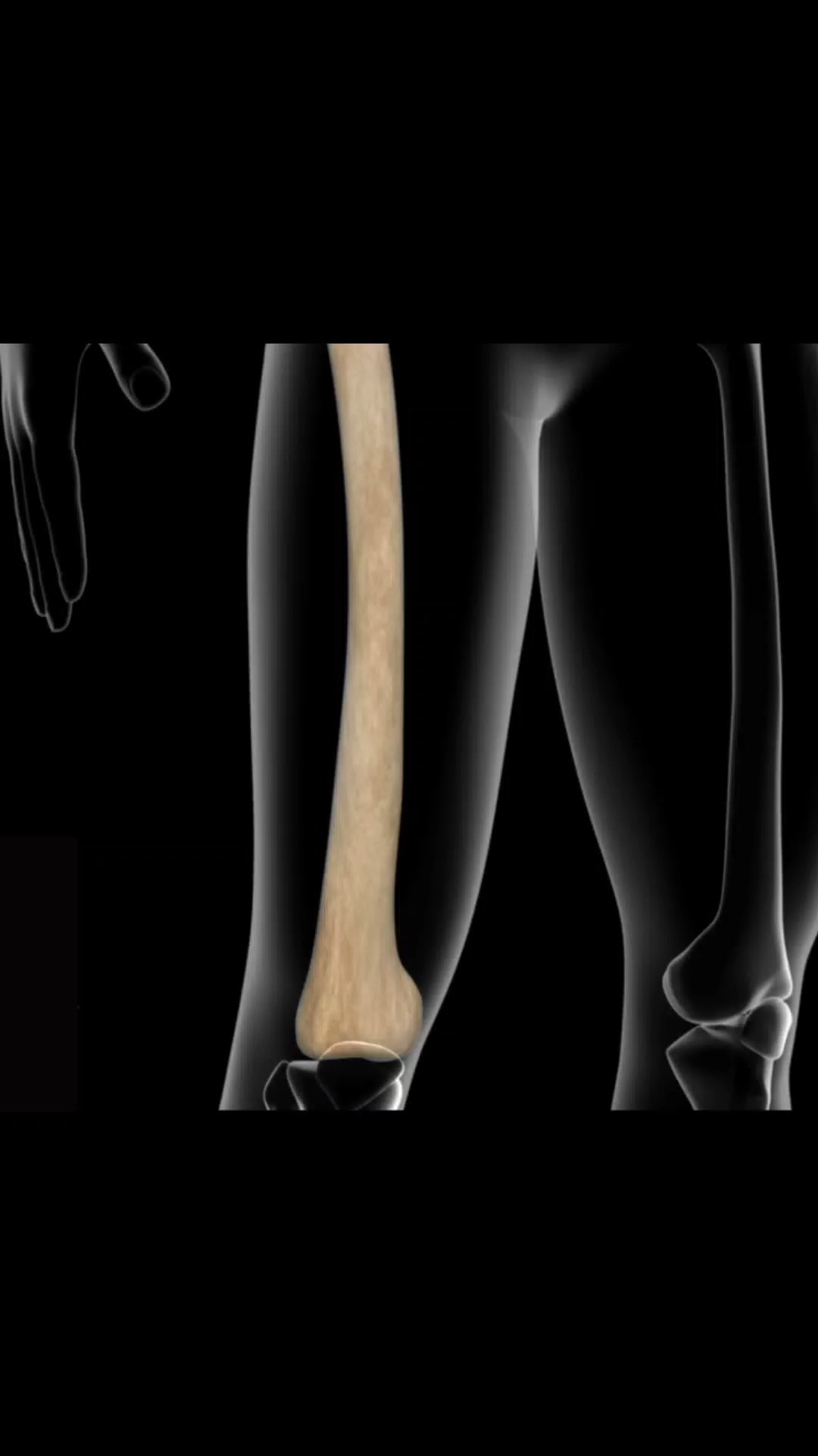 Bone-fracture Object Detection Dataset by home