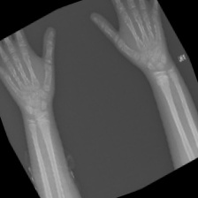 broken bones Instance Segmentation Dataset and Pre-Trained Model by Will Class