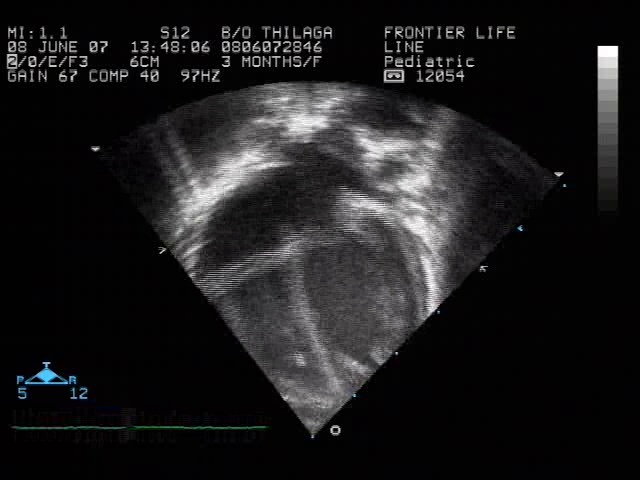 echo_info Object Detection Dataset and Pre-Trained Model by echo