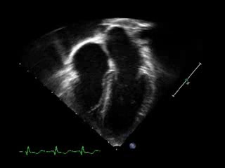 echo_view_object_detect Object Detection Dataset by echo