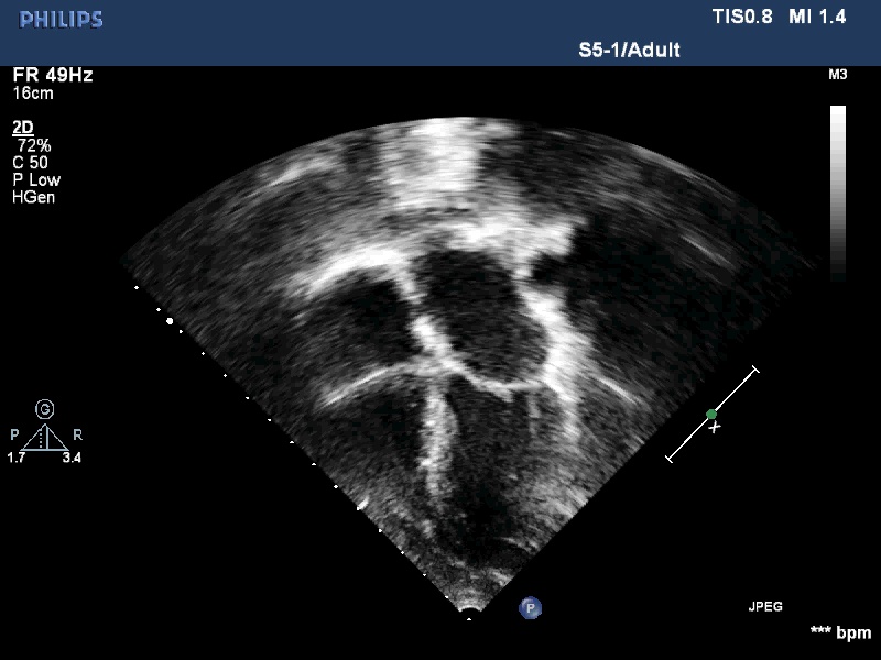opt_subopt Instance Segmentation Dataset by echo