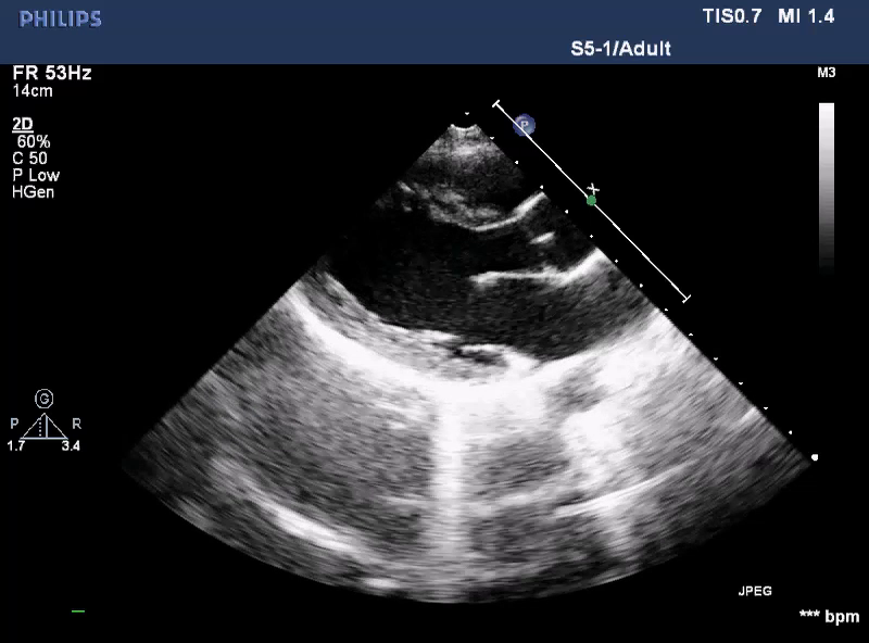 plax2 Instance Segmentation Dataset by echo