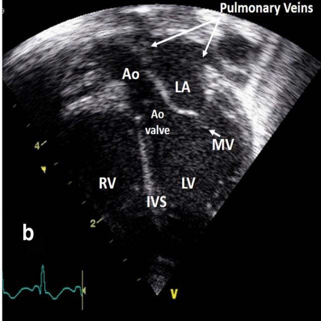 blank_sector Instance Segmentation Dataset by echo