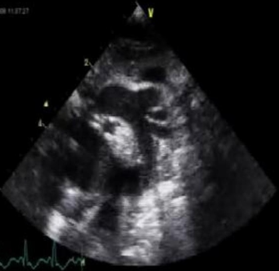 echo_view_crop Classification Dataset by echo