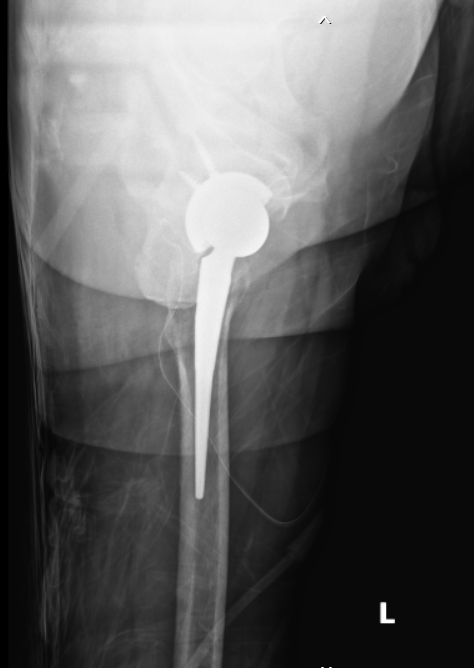 Stem types Object Detection Dataset and Pre-Trained Model by STEM 5 types