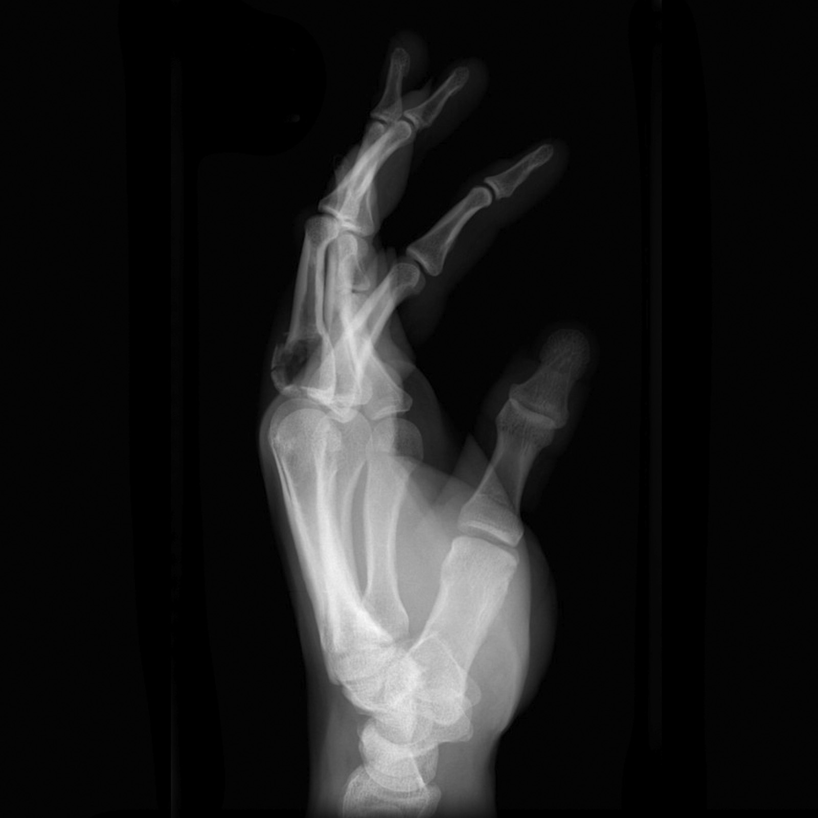 Eastwind Instance Segmentation Dataset by hello world