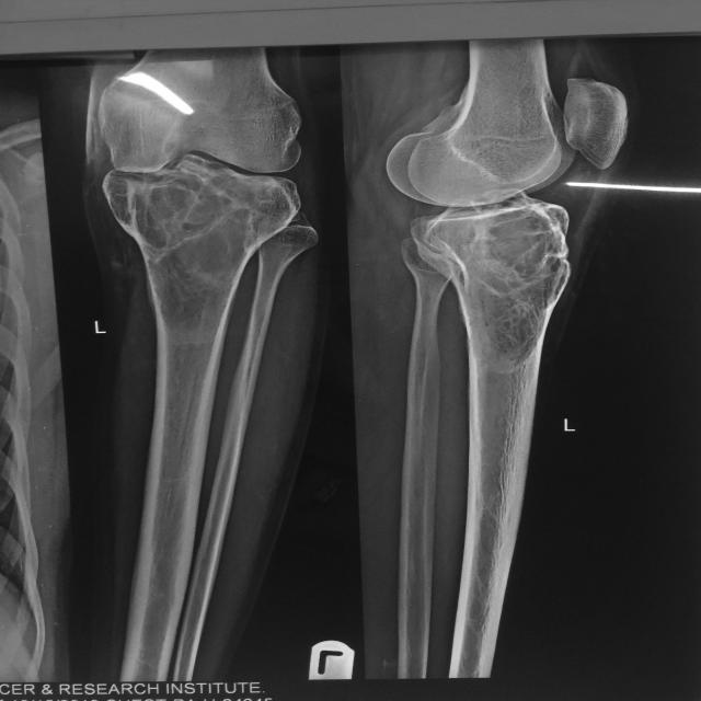 cancer Instance Segmentation Dataset by hello world