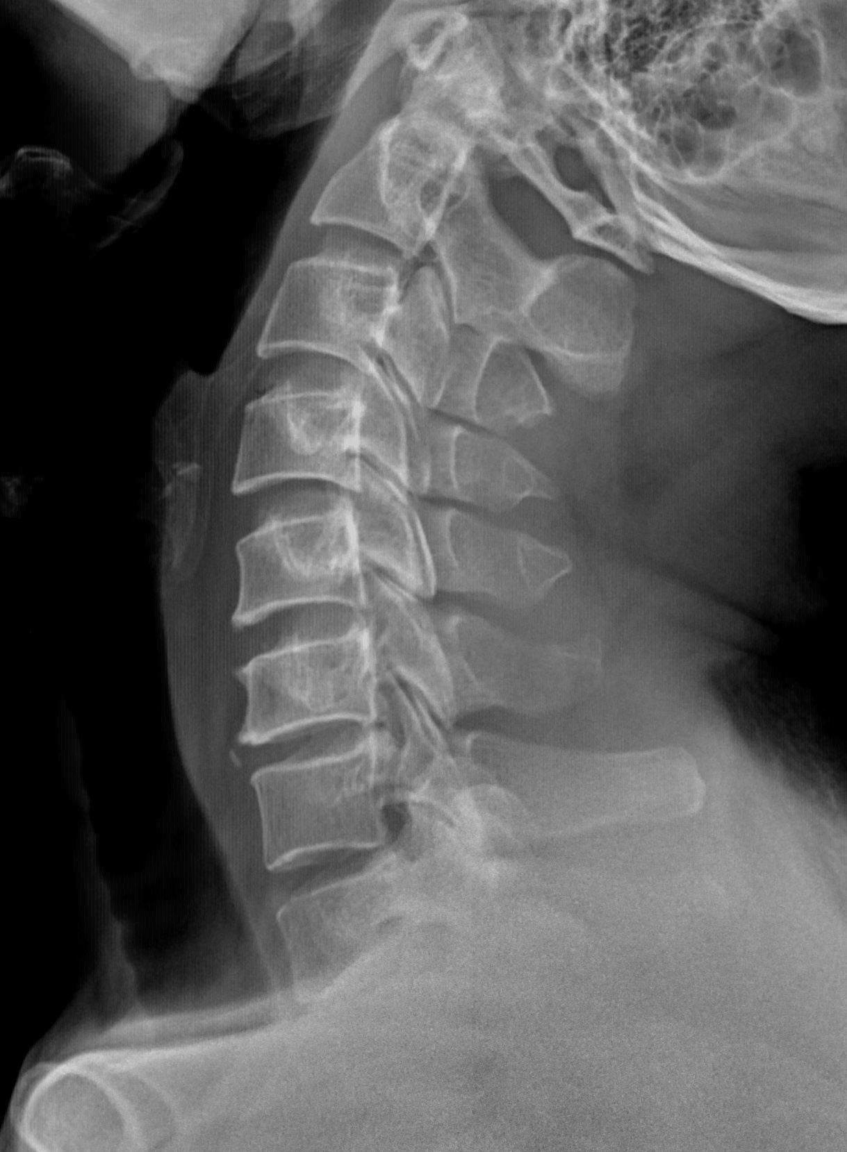 v5 Object Detection Model by Sankirtana Guntuboina