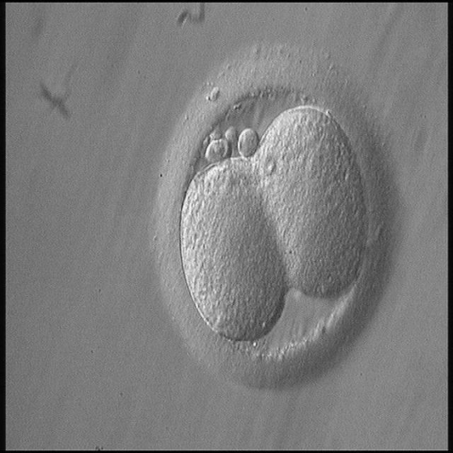 2 Cell Embryo 1085 Object Detection Model by 360DigitMTDataSceicecAI