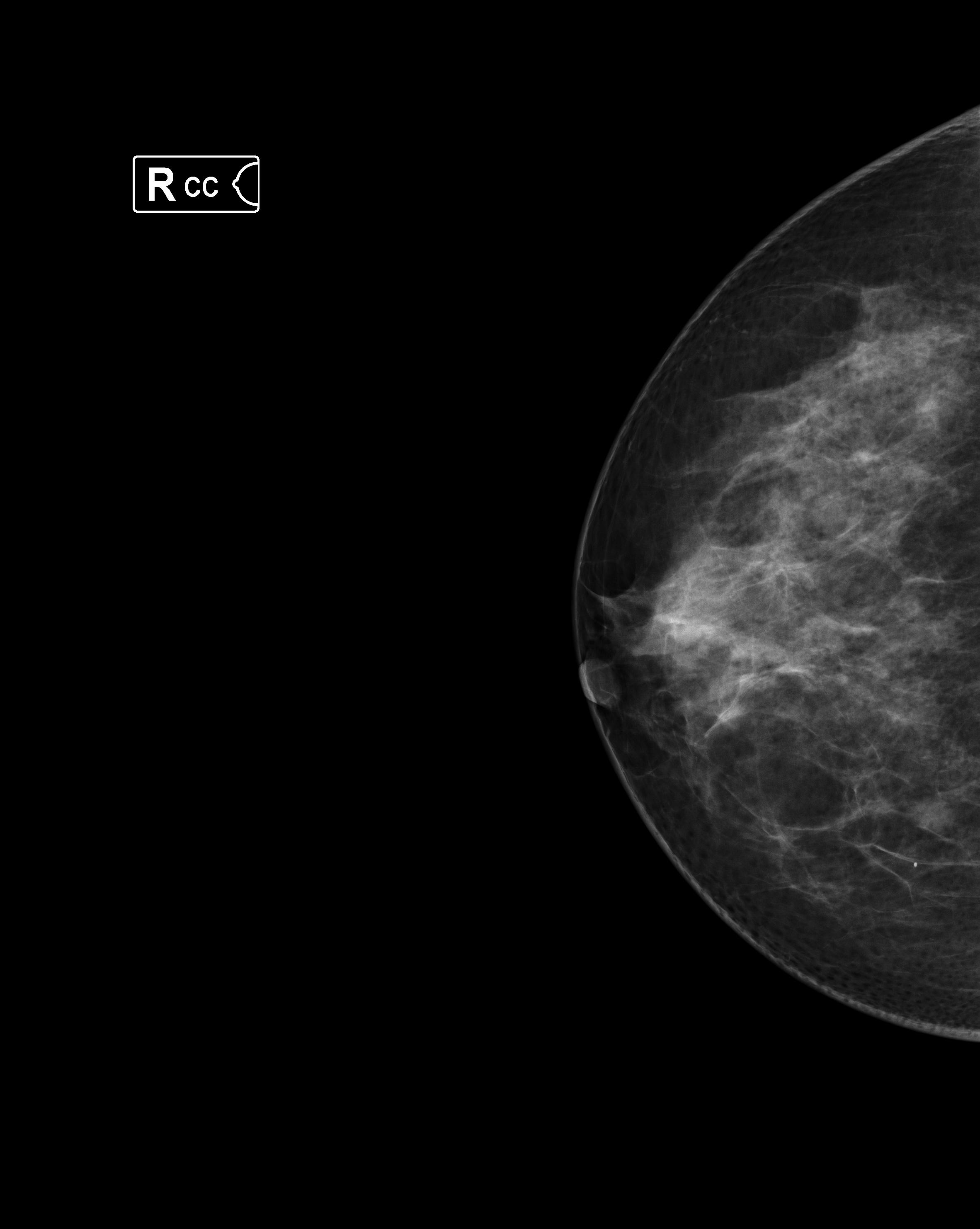 Vintek Object Detection Dataset And Pre Trained Model By Teknofest