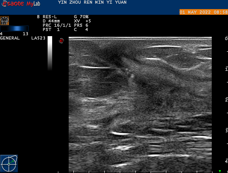 How to Use the cropped ultrasound image Object Detection API